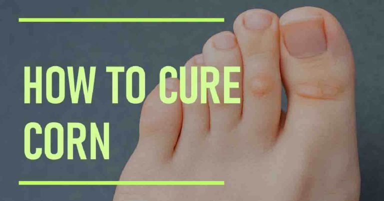 How To Cure Corn: 10 Pain-Free Solutions To Relieve Your Feet!