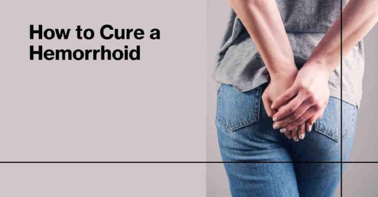 How To Cure A Hemorrhoid: Quick & Easy Fixes!