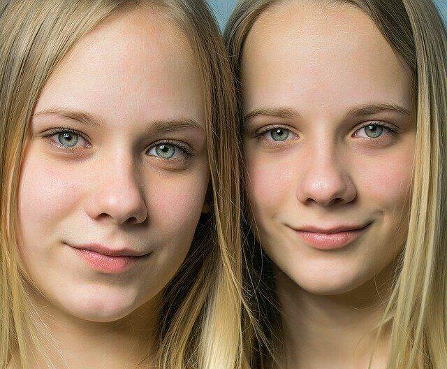 4 Difference Between Monozygotic And Dizygotic Twins
