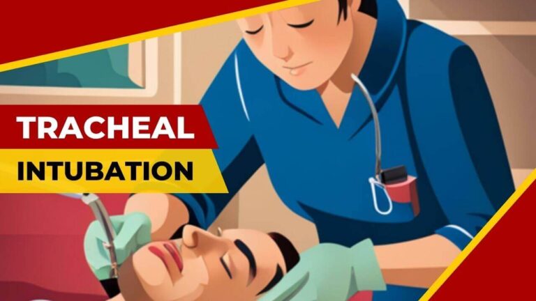 Tracheal Intubation: Ensuring Lifesaving Airway Access With Expert ...