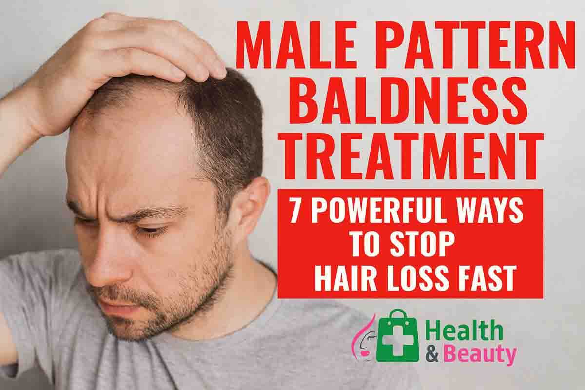 Male Pattern Baldness Treatment: 7 Powerful Ways To Stop Hair Loss Fast